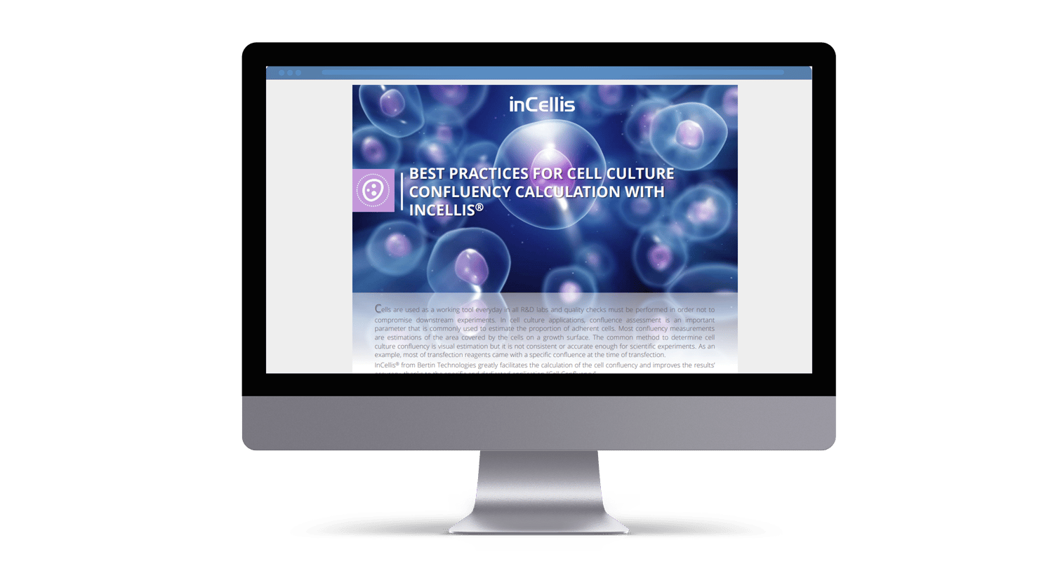 Best Practices for Cell Culture Confluency Calculation With InCellis®