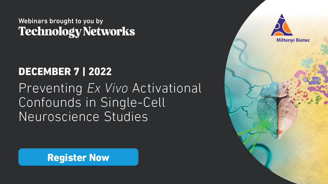 Preventing Ex Vivo Activational Confounds in Single-Cell Neuroscience ...