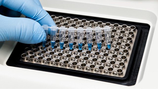 Tips for Improving Your qPCR